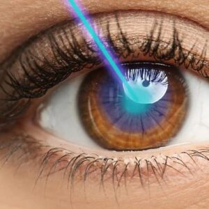 SMILE Eye Surgery- Procedure, Benefits, Cost, Risks & More