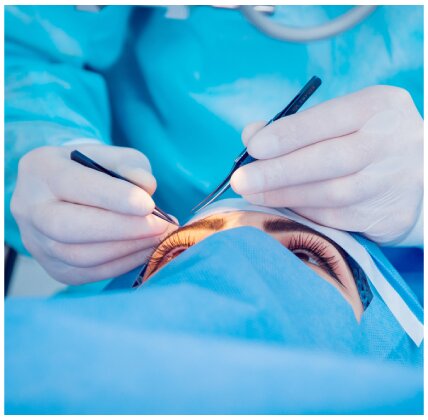 Different RLE Surgery Doctor In Ahmedabad - Laser Lasik Eye Surgery